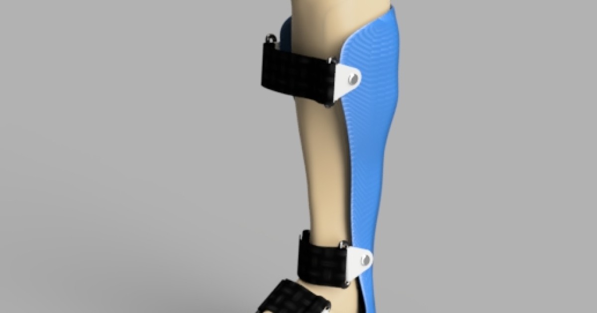 AFO (Ankle Foot Orthosis) | Autodesk Community Gallery