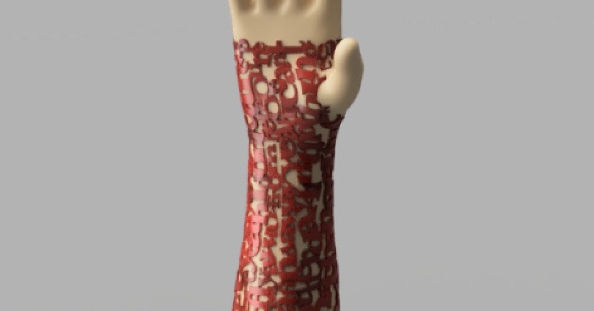 3D printing splint with text | Autodesk Community Gallery