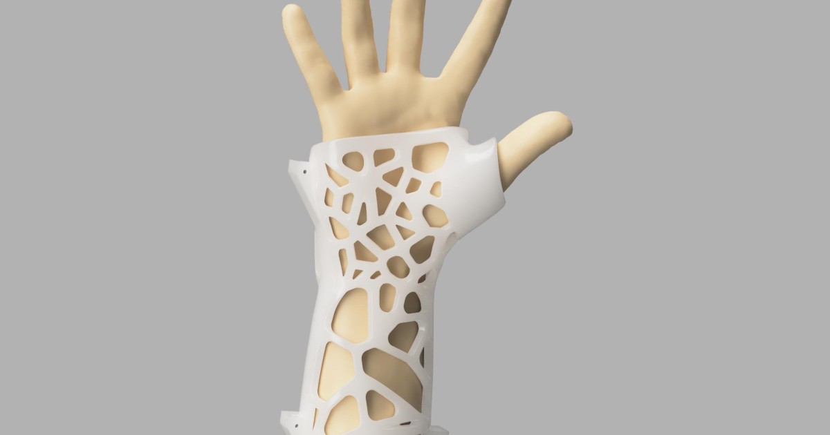 Voronoi WHO | Autodesk Community Gallery